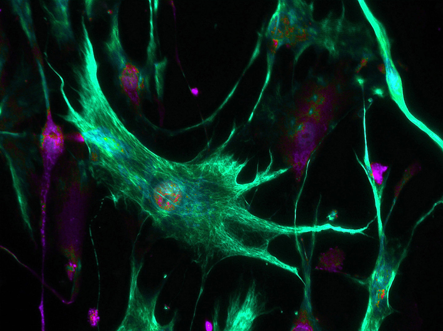 Ghost Cell - May Image Contest - NeuroArt Image Contest